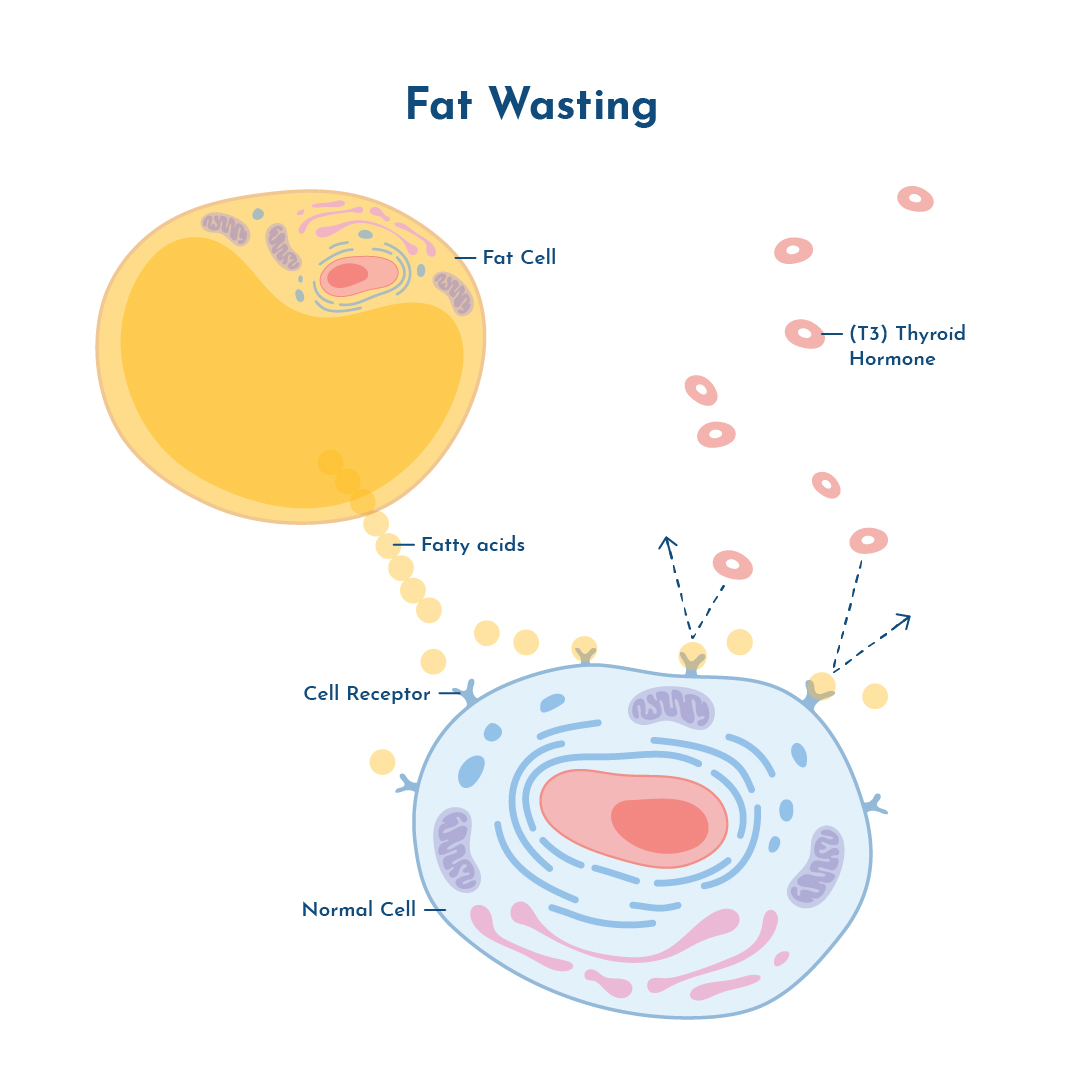 HypothyroidismWeightLoss_FatWasting